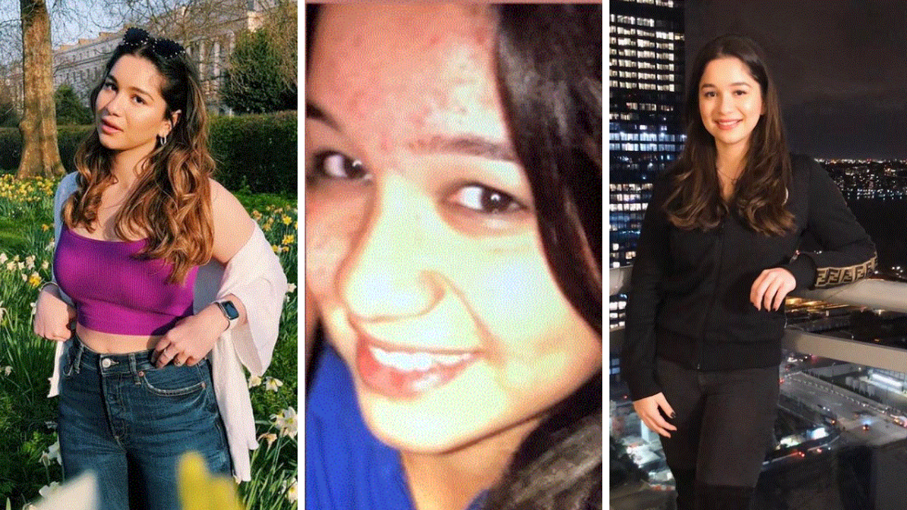 Sachin Tendulkar's daughter Sara shares photo of her pimple-ridden skin ...